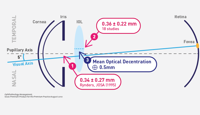 The Importance of Analysing the Angle Kappa and Alpha Before Implanting ...
